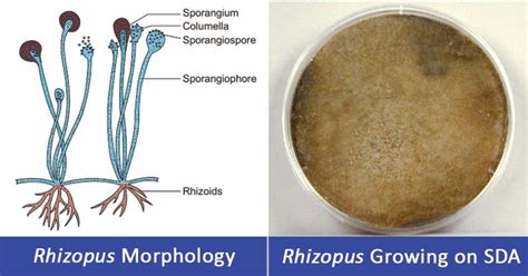 Rhizopus Spp An Overview