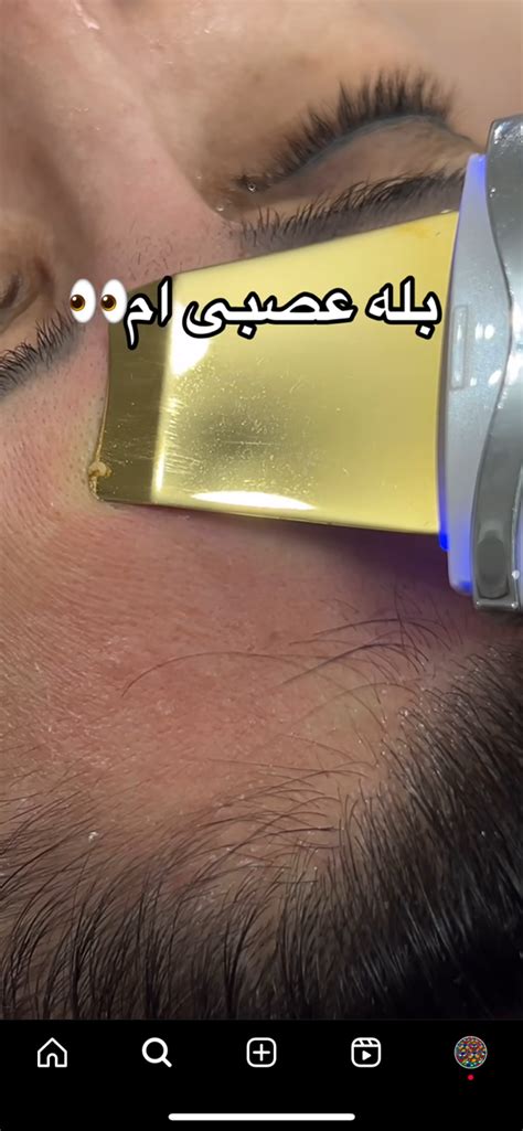 اسم این دستگاه چیه مال پاکسازی پوست عکس تبادل نظر نی نی سایت