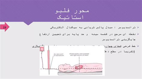 Monitoring Anesthesia Pptx