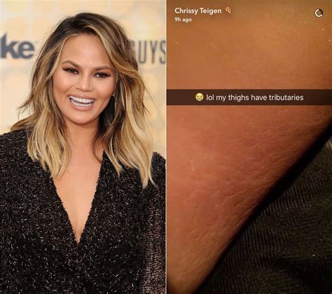 Does Bio Oil Clear Stretch Marks Heres The Truth Skinrevs