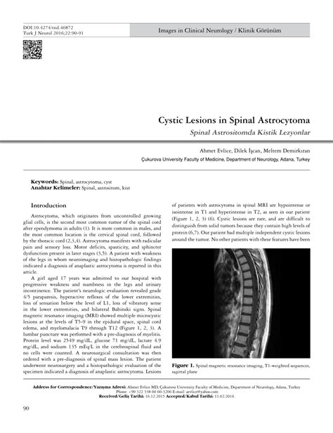 Pdf Cystic Lesions On Spinal Astrocytoma