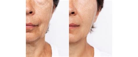 Bukan Aloe Vera Ini Trik Bikin Gel Antiaging Agar Keriput Pudar Pakai