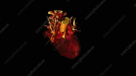 Beating Heart Ct Scan Stock Video Clip K004 9581 Science Photo Library