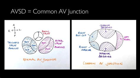 Avsds Oxford Achd Echo
