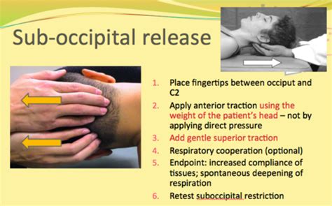 Suboccipital Release Technique