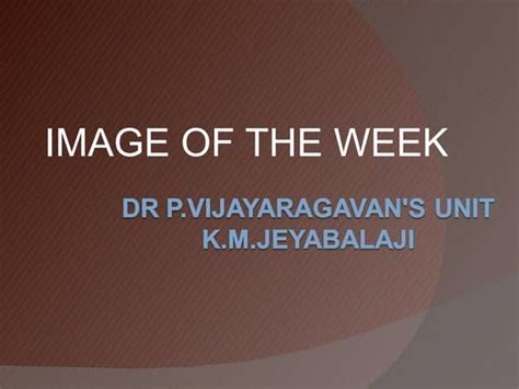 X Ray Miliary Tuberculosis Ppt