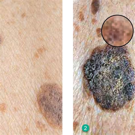 An Example Of Performing General Histogram Enhancement Of The Skin Download Scientific Diagram