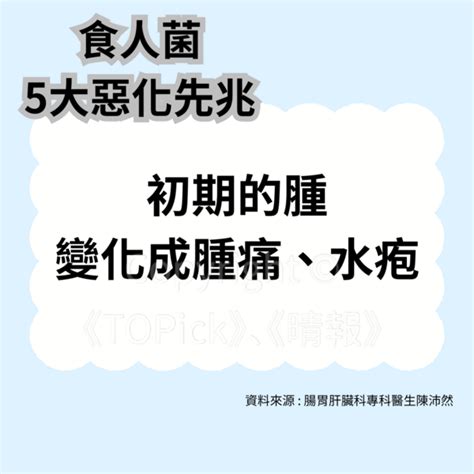 日本食人菌︱日本「食人菌」破千病例嚴重可致死 醫生拆解5大惡化先兆