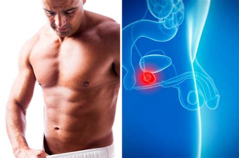 Antibiotics For Prostatitis Symptoms