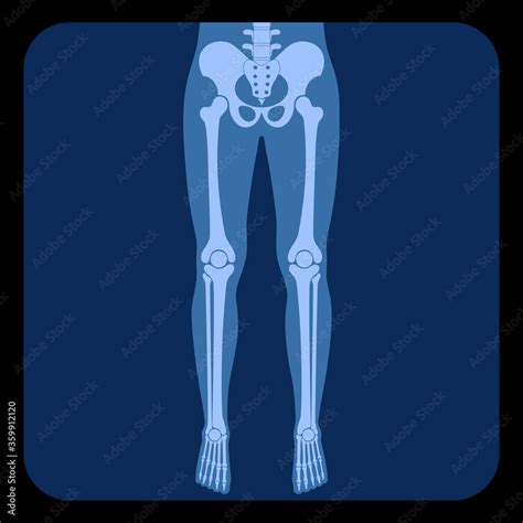 Skeleton X Ray Stock Vector Adobe Stock