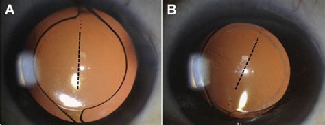 Machine Learning How To Determine The Rotation Of An Objects Relative