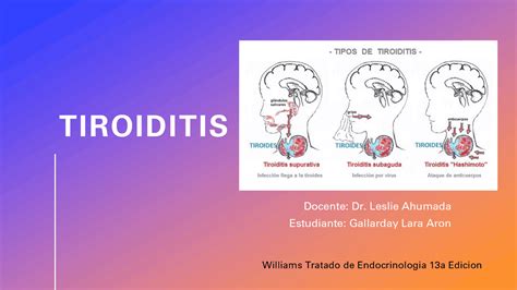 Tiroiditis Tiroiditis Autoinmunitaria Tiroiditis Subaguda Indolora