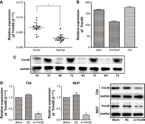 Trim59 Is Upregulated In Bca Cell Lines And Tissues Notes A The