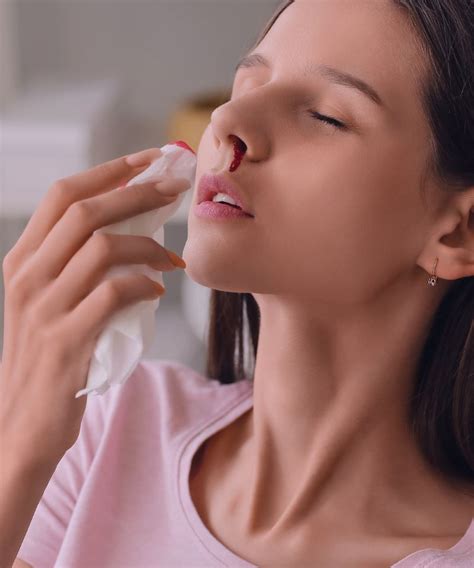 Are Accutane Side Effects Permanent
