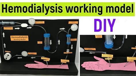 Dialysis Working Model For Science Project Exhibition Free 41 Off