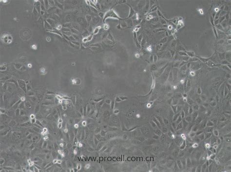 Panc 0327 人胰腺癌细胞 Str鉴定正确 武汉普诺赛生命科技有限公司 您身边的细胞专家【官方网站】
