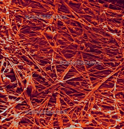 Collagen Under A Microscope Sem Stock Image Science Source Images