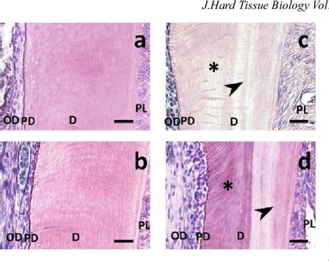 Figure 3 From Histological Analysis Of Dentinogenesis Imperfecta In
