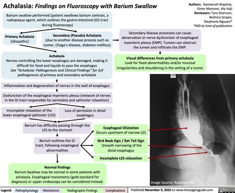 Achalasia Findings On Fluoroscopy With Barium Swallow Calgary