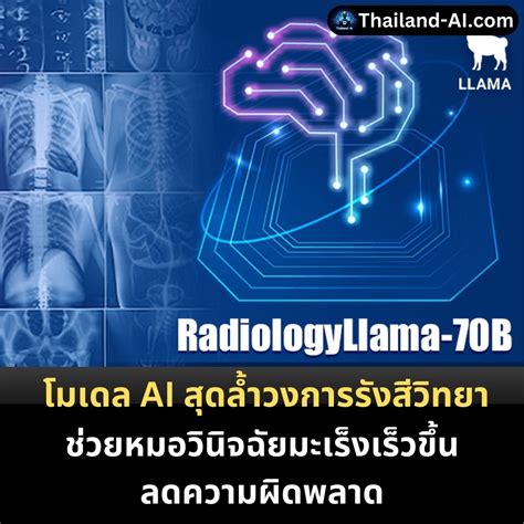 Thailand 🚨 ด่วน Radiologyllama 70b โมเดล Ai สุดล้ำผงาดวงการรังสีวิทยา 🔥 ช่วยหมอ
