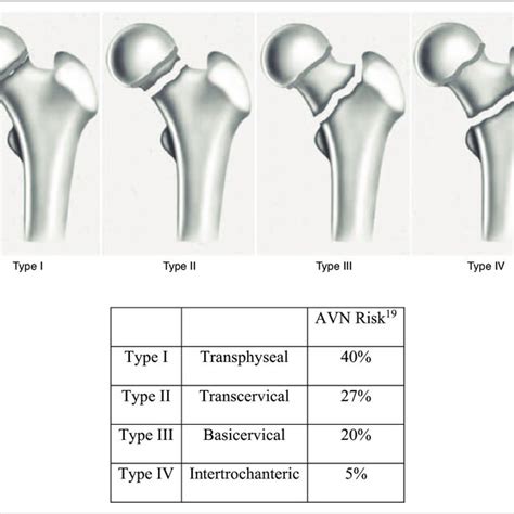 Delbet Classification Of Femoral Neck Fractures Download Scientific