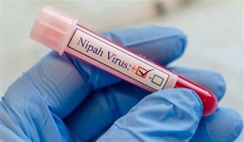 National Institute Of Virology Develops Portable Kit For Rapid Nipah