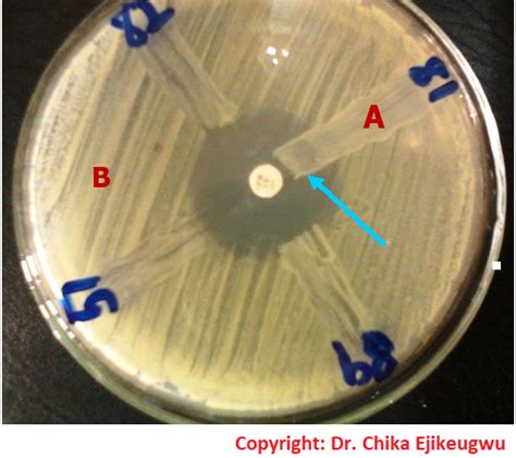 Inoculating Loop Microbiology Class