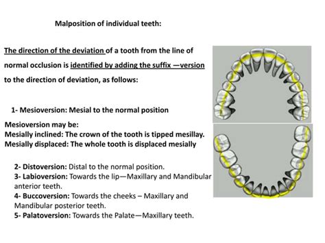 Classification Of Occlusion And Malocclusion Dr Nabil Al Zubair Pdf