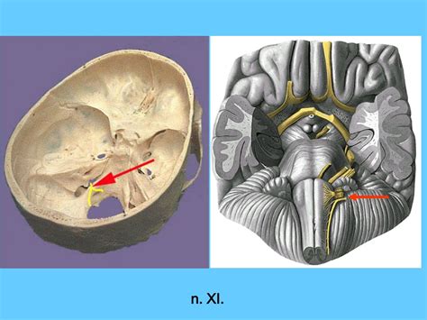 Ppt Nervus Facialis Powerpoint Presentation Free Download Id 8733288