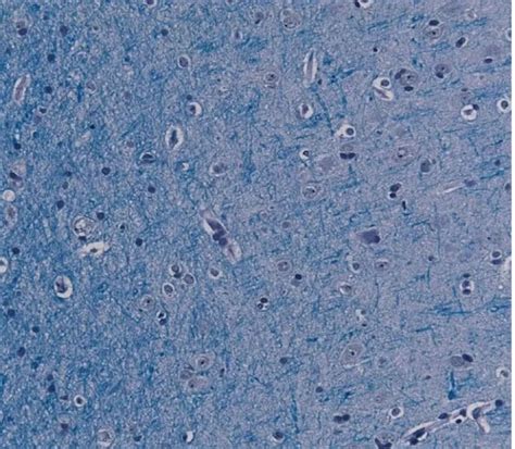 Luxol Fast Blue Mbs 25g Emgrid Australia 61 8 8250 3687