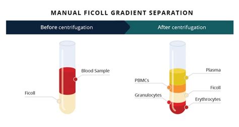 Unveiling The Secrets Of Pbmc Isolation Tubes Clinching Clinical Trial Success With The Right Tools