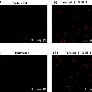 Fluorescence Micrographs Of E Coli And S Aureus That Are Treated And