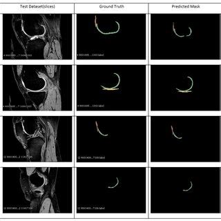 Pdf Knee Cartilage Segmentation Using Improved U Net