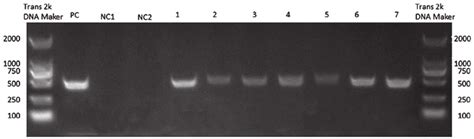 Rt Pcr Detection Of Hcv Infection In Sf268 Cells Rt Pcr Was Performed