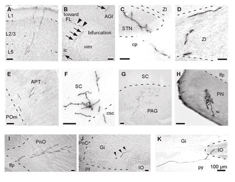 Representative Examples Of Axonal Collaterals In The Target Structures Download Scientific