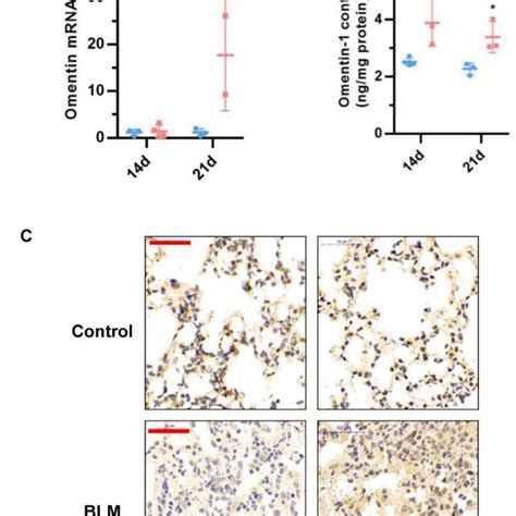 The Expression Level Of Omentin 1 In Mouse Lung Tissue After Bleomycin