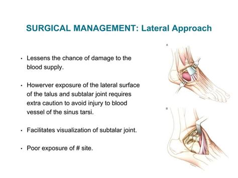 Talus Fracture Treatment Algorithm Ppt