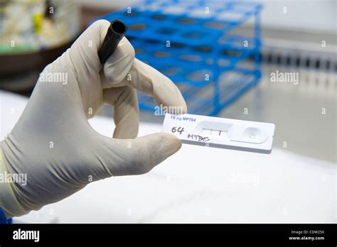 Tb Test Hi Res Stock Photography And Images Alamy