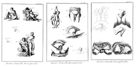 Hermaphroditic Clinical Images