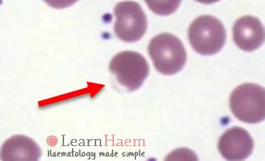 Helmet Cells