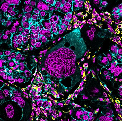 Stress Responders Giant Polyploid Cells 3 Quarks Daily