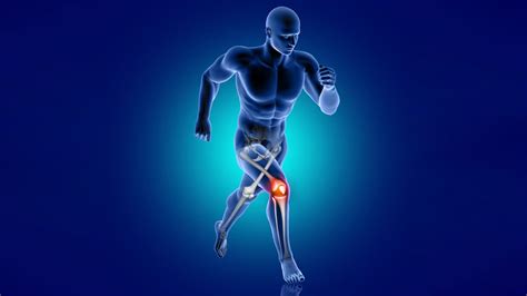 Uncommon Reasons That Can Cause Gout Onlymyhealth