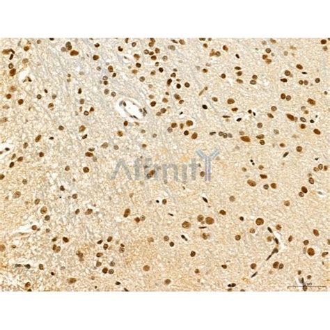 Osterix Antibody Affinity Biosciences