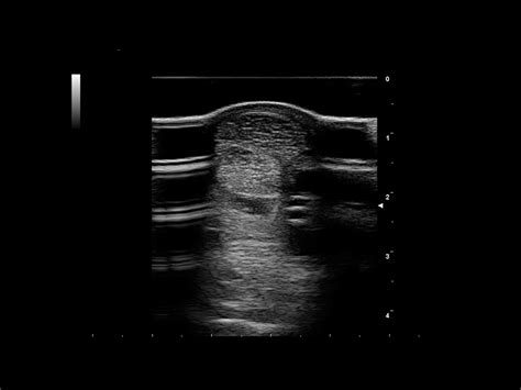 Equine Ultrasound Veterinary Clinical Solutions Esaote