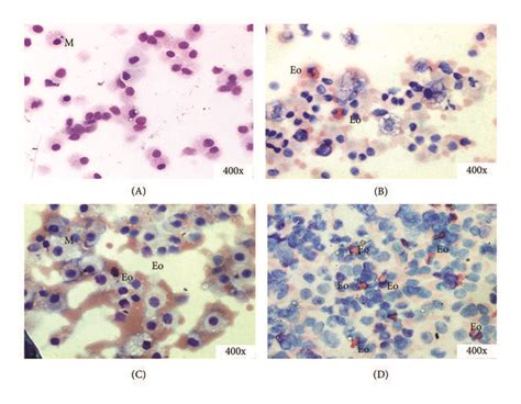 The Infiltration Of Inflammatory Cells In Different Groups A