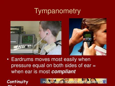 Ppt Tympanometry Powerpoint Presentation Free Download Id647193
