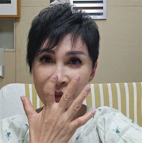 可怕紅斑性狼瘡！王瑞玲「手指變形」開刀又感染 昏厥心跳僅45