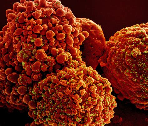 Coffee Compound Reduces Binding Of Sars Cov 2 Virus To Its Human Target