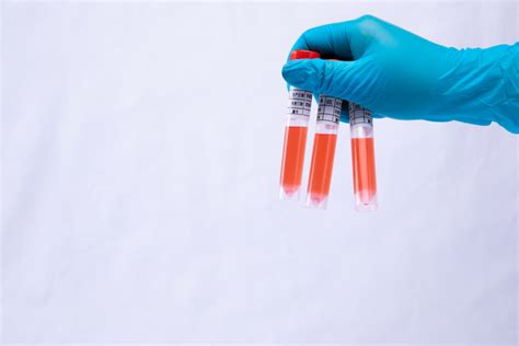 生物化学素材 生物化学模板 生物化学图片免费下载 设图网