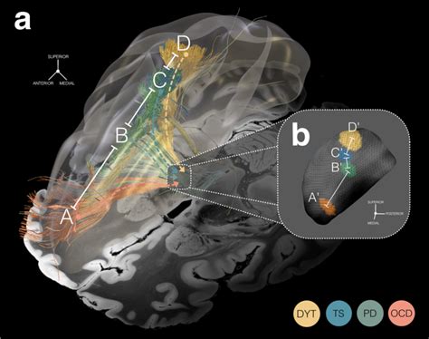 spatial compression of functional inputs from the cortex within the